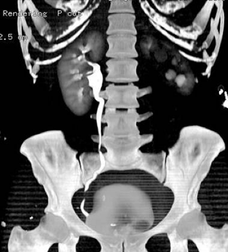 C10FF12C.gif | Abdominal Key