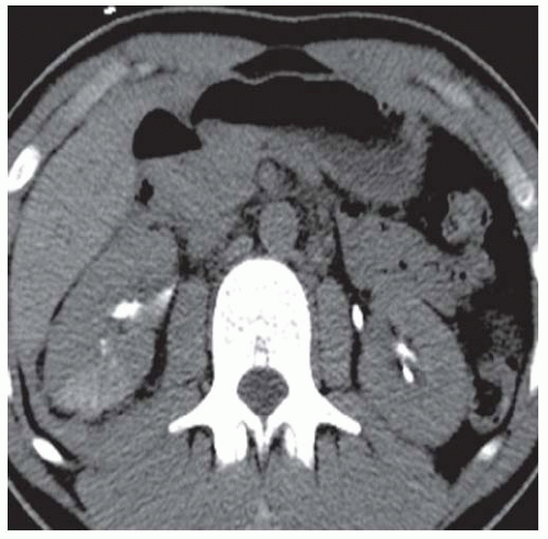 C11-FF30.gif | Abdominal Key