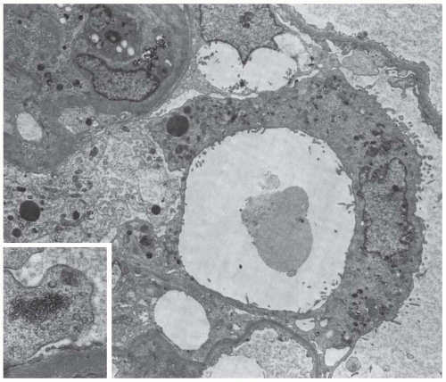 C13-FF20.gif | Abdominal Key