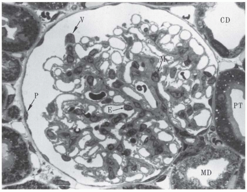C13-FF3.gif | Abdominal Key