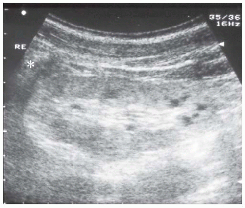 C15-FF6.gif | Abdominal Key
