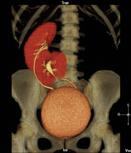 C4FF16D.gif | Abdominal Key