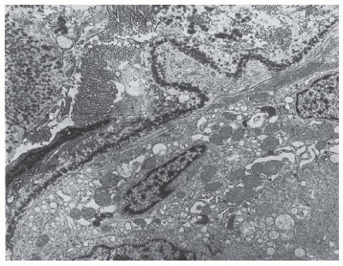 C60-FF14.gif | Abdominal Key