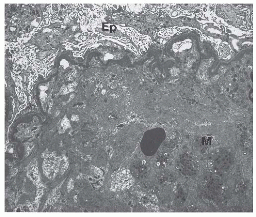C60-FF15.gif | Abdominal Key