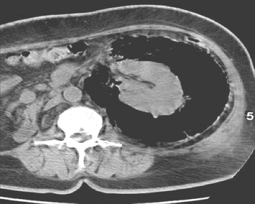 C6FF8A.gif | Abdominal Key