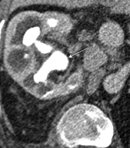 C8FF19B.gif | Abdominal Key