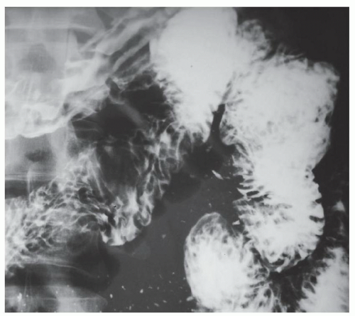 C1-FF193.gif | Abdominal Key