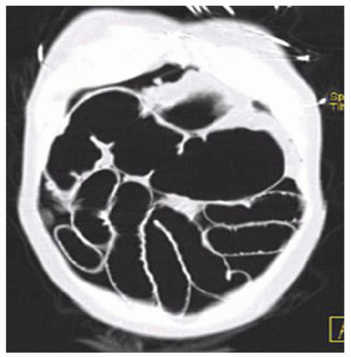 C1-FF226.gif | Abdominal Key