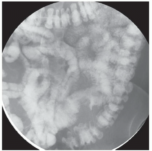 C1-FF232.gif | Abdominal Key