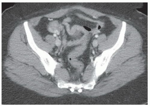 C1-FF253.gif | Abdominal Key