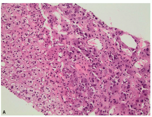 C10-FF12.gif | Abdominal Key