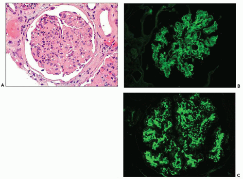 C10-FF30.gif | Abdominal Key