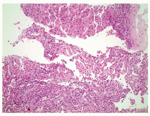 C11-FF12.gif | Abdominal Key