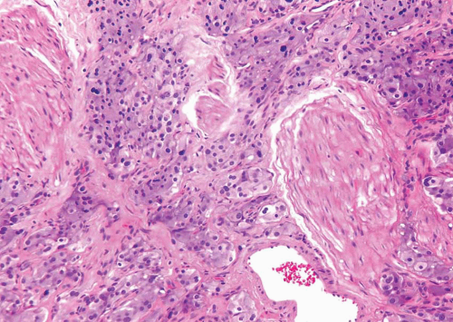 C12-FF20.gif | Abdominal Key