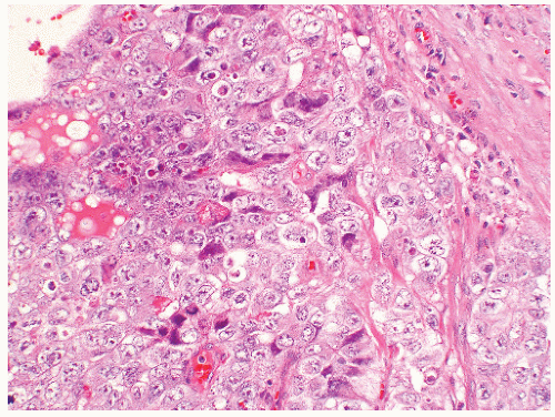 C12-FF30.gif | Abdominal Key