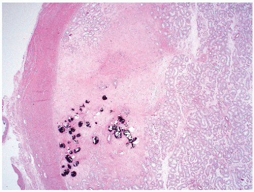 C12-FF67.gif | Abdominal Key