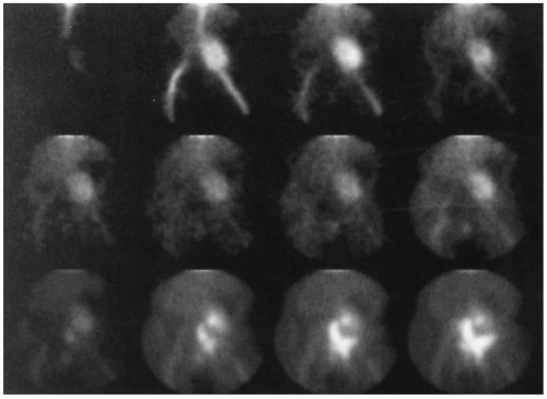 C13-FF3.gif | Abdominal Key