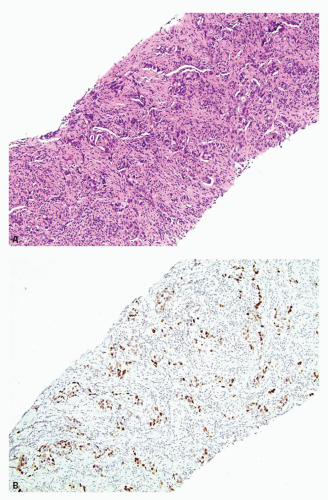 Ancillary Tests Abdominal Key