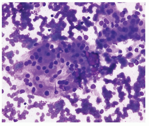 C14-FF12.gif | Abdominal Key