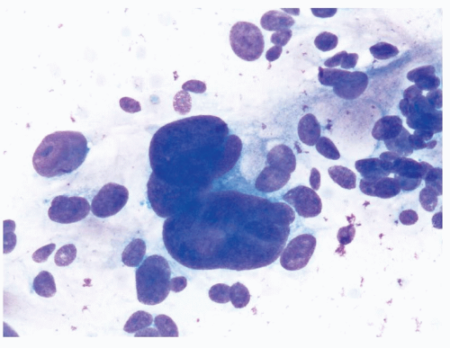 C14-FF22.gif | Abdominal Key