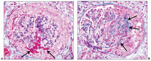 C15-FF10.gif | Abdominal Key