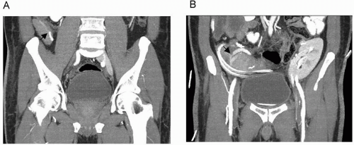 C15-FF10.gif | Abdominal Key