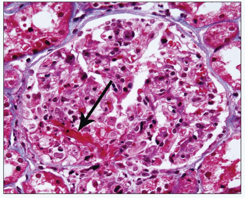 C15-FF11.gif | Abdominal Key