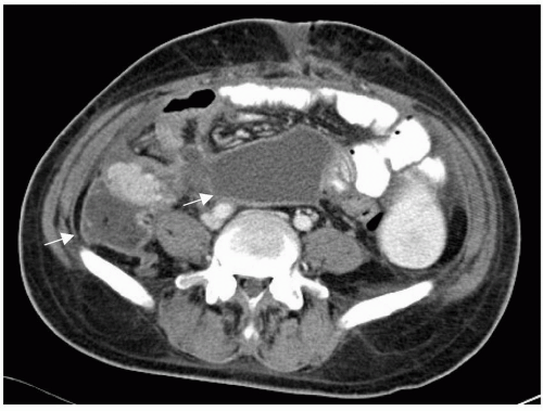 C15-FF11.gif | Abdominal Key