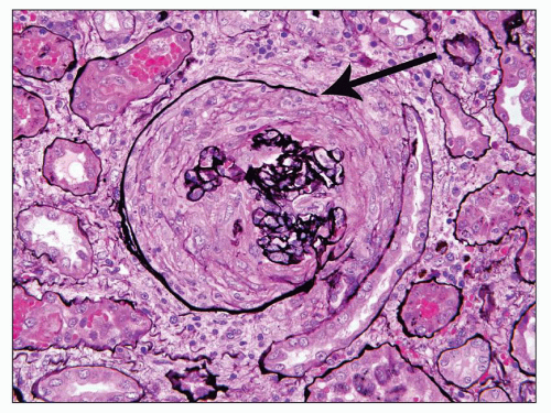 C15-FF13.gif | Abdominal Key