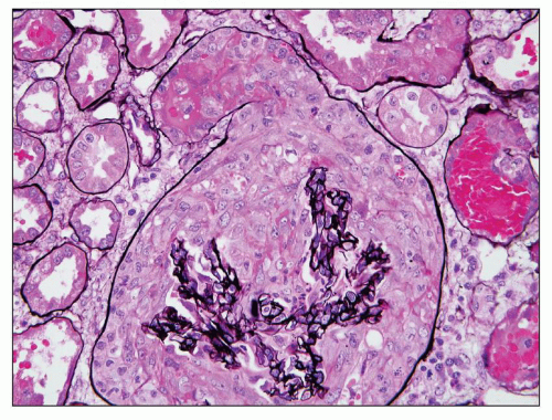 C15-FF14.gif | Abdominal Key