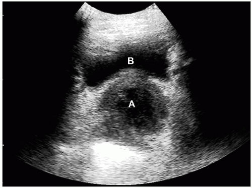 C15-FF16.gif | Abdominal Key