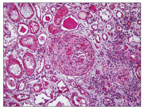 C15-FF20.gif | Abdominal Key