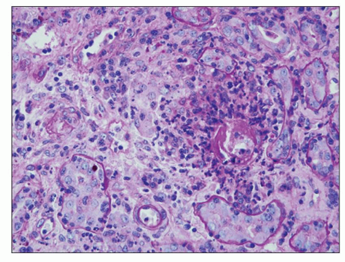 C15-FF21.gif | Abdominal Key