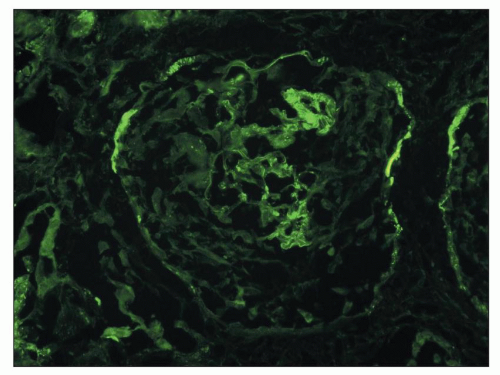 C15-FF26.gif | Abdominal Key