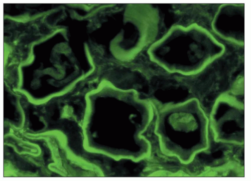 C15-FF27.gif | Abdominal Key