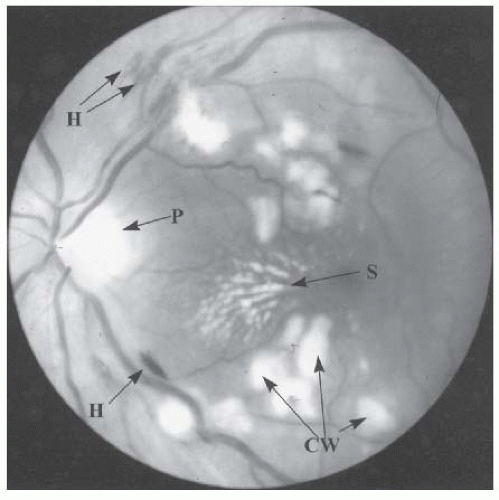 C15-FF3.gif | Abdominal Key