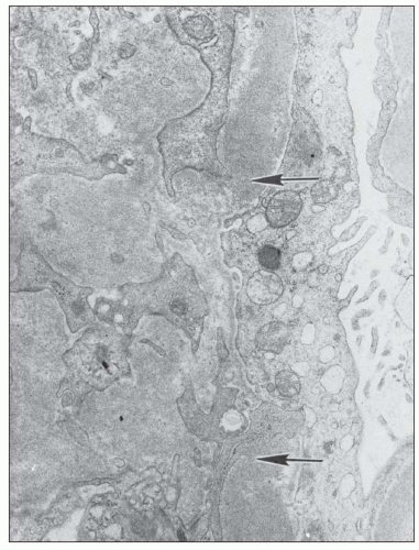 C15-FF31.gif | Abdominal Key