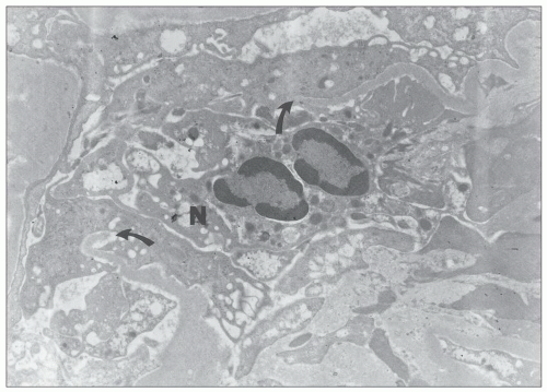 C15-FF32.gif | Abdominal Key