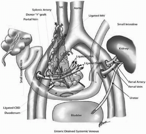 C15-FF6.gif | Abdominal Key