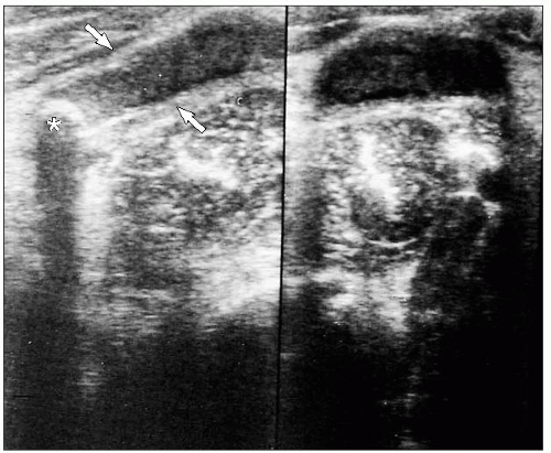 C15-FF7.gif | Abdominal Key