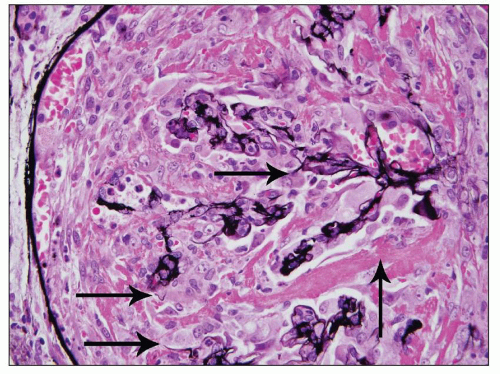 C15-FF8.gif | Abdominal Key