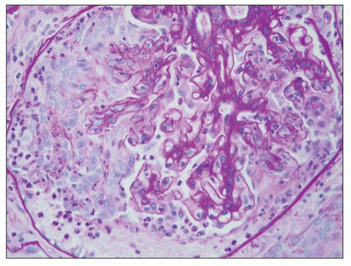 C15-FF9.gif | Abdominal Key