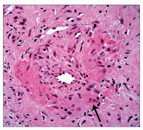 C17-FF22.gif | Abdominal Key