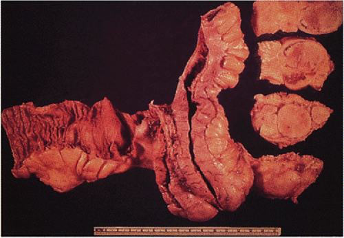 C17FF45.gif | Abdominal Key