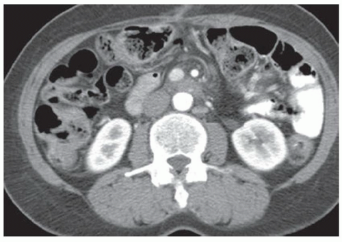 C2-FF138.gif | Abdominal Key