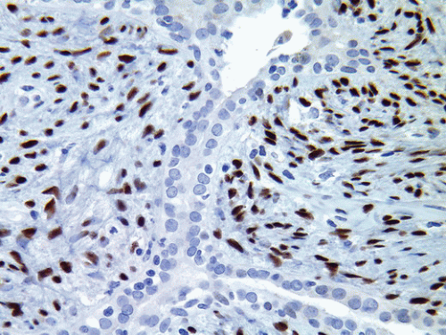 C2-FF138.gif | Abdominal Key