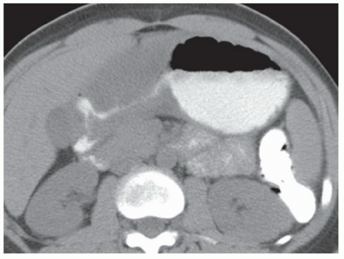 C2-FF166.gif | Abdominal Key
