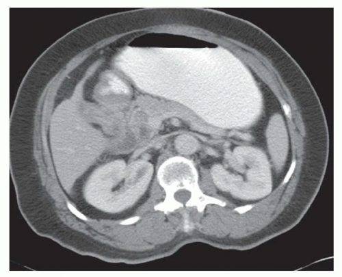 C2-FF193.gif | Abdominal Key
