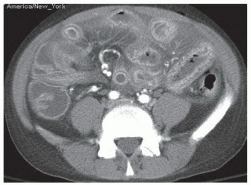 C2-FF207.gif | Abdominal Key