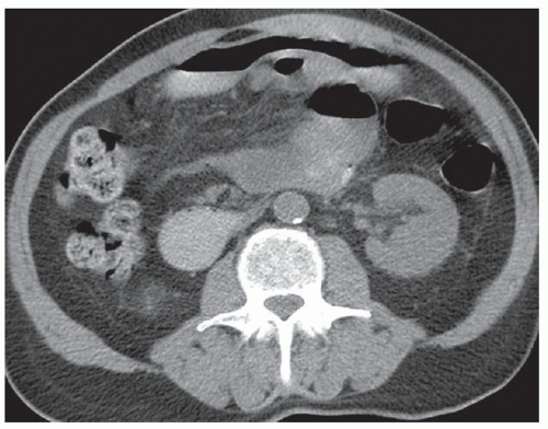 C2-FF224.gif | Abdominal Key